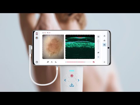 Dermus | Introducing SkinScanner | 2024