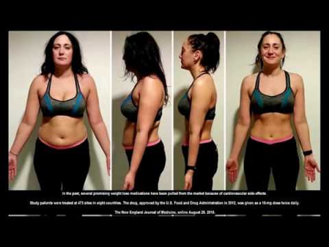 Lorcaserin - Weight Loss Drug Lorcaserin Found Safe in Large Study Lorcaserin Reviews
