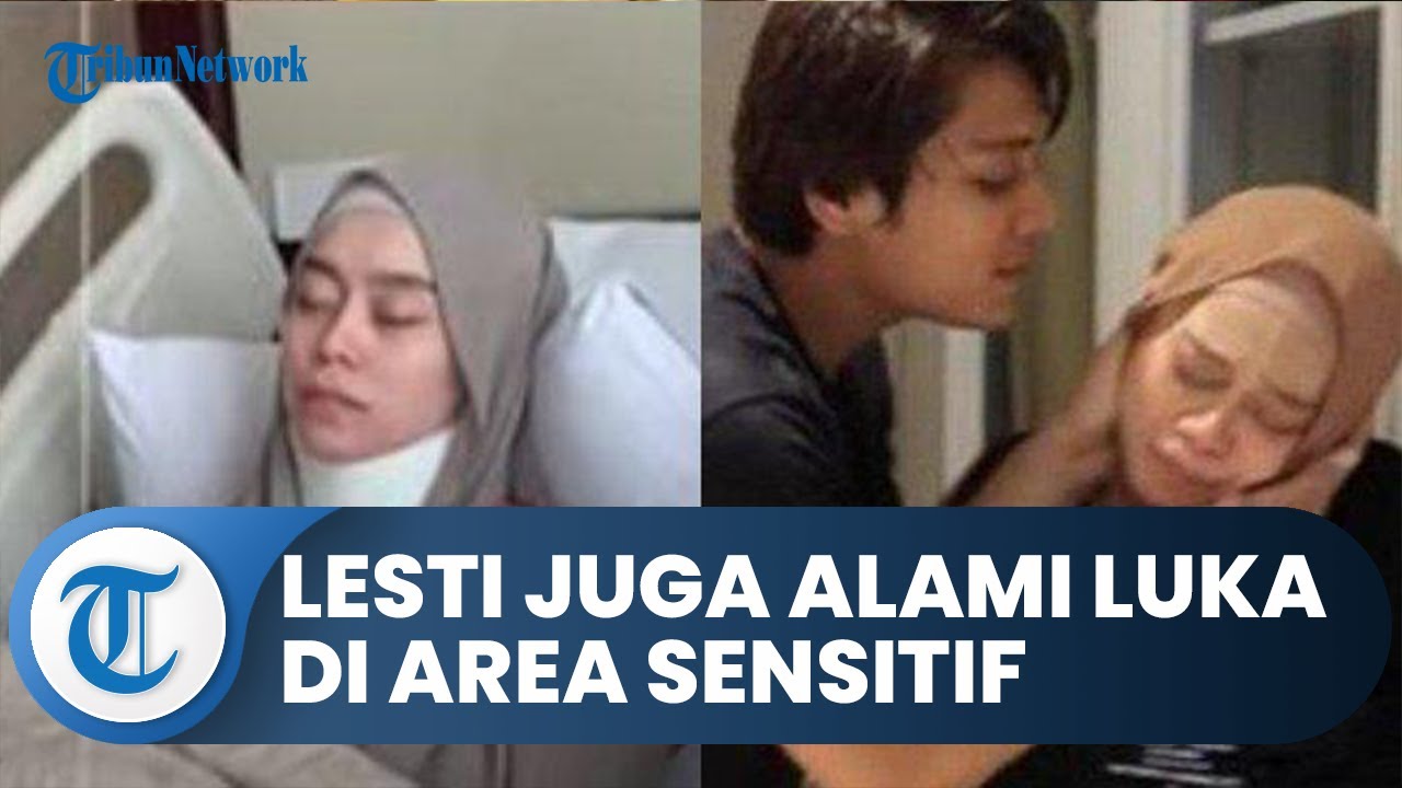 Tak Hanya Leher, Polisi Sebut Lesti Juga Alami Luka di Bagian Sensitif yang Tak Bisa ...
