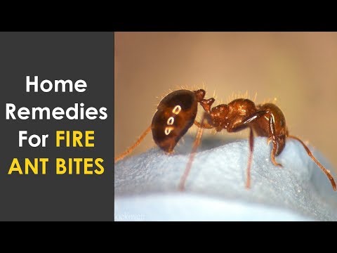 Home Remedies To Get Rid Of Fire Ant Bites