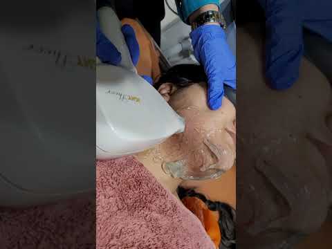 Laser Hair Reduction