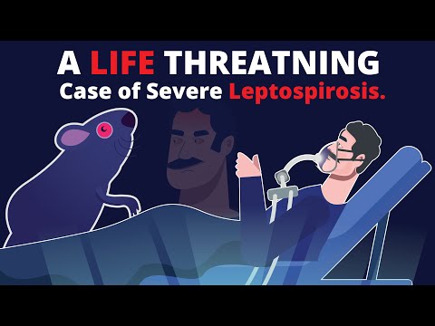 What is Leptospirosis? How does it cause Organ Failure? & How to treat?