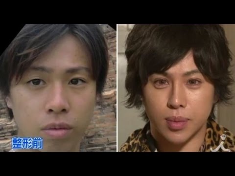 Japanese Man Spends $150,000 on Plastic Surgery to Look Like Michelangelo’s David