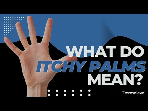 What Do Itchy Palms Mean? - Dermeleve®