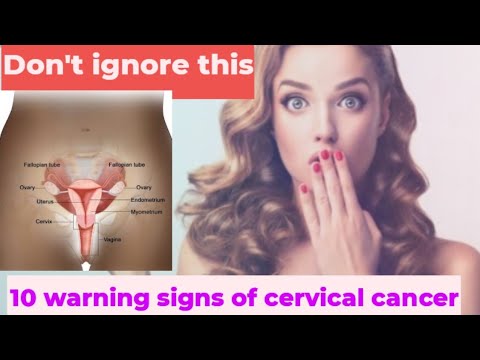 10 Warning Signs of Cervical Cancer Every Woman Should Know | Early Detection & Prevention