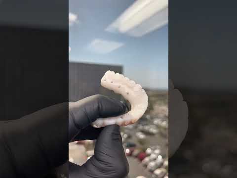 Perfection Personified: The Beauty of a Zirconia Prosthesis