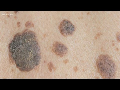 How to use telemedicine appointments for dermatology