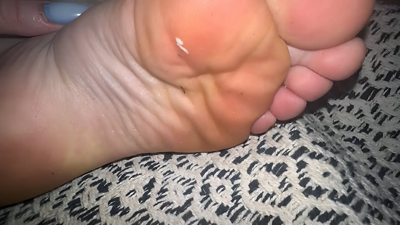 SWEATY, BUTTERY FEET 