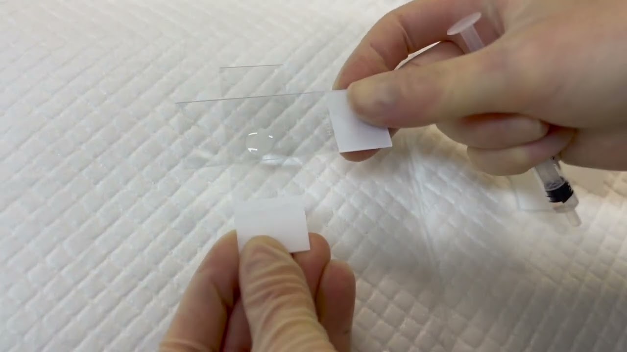 Making slides from joint fluid and staining