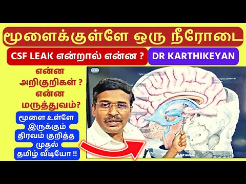 csf leaky brain மூளைக்குள்ளே ஒரு நீரோடை - cerebro spinal fluid awareness