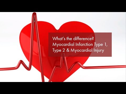 Myocardial Infarction Type 1, Type 2 & Myocardial Injury Explained