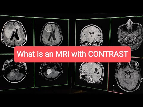 What is an MRI with Contrast | Explained in details in English.