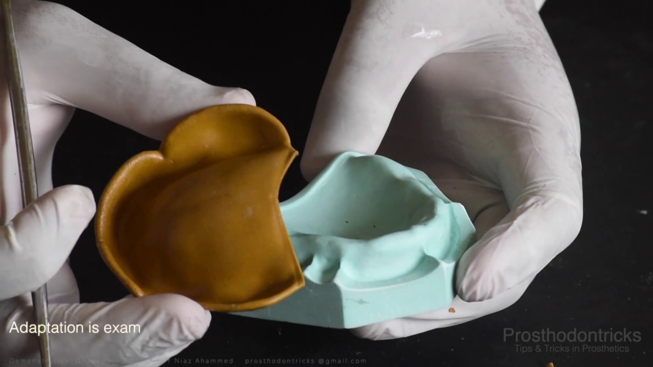 Preclinical Prosthodontics: Maxillary shellac Base plate adaptation.