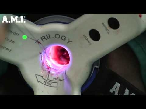 Calicut Surgicals-Ex-Im, Kozhikode - Wholesale Trader of Doppler ...