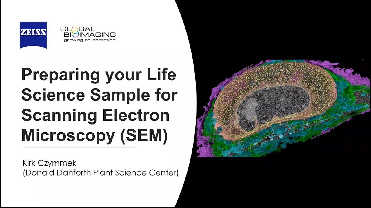 Sample Preparation for Scanning Electron Microscopy (SEM) in Life Sciences
