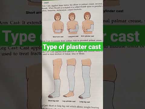 type of plaster cast. #structure #fracture #bone ..