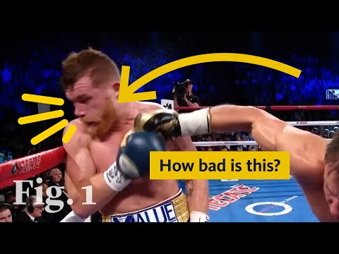 When does a concussion actually become dangerous?