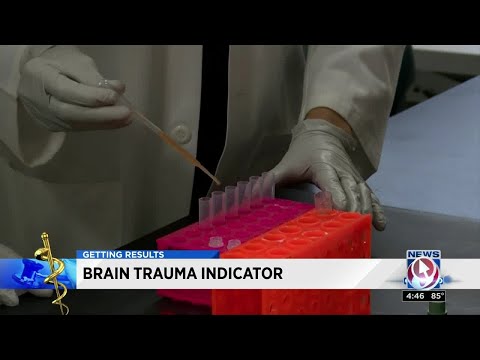 Brain trauma blood test indicator test gets approval