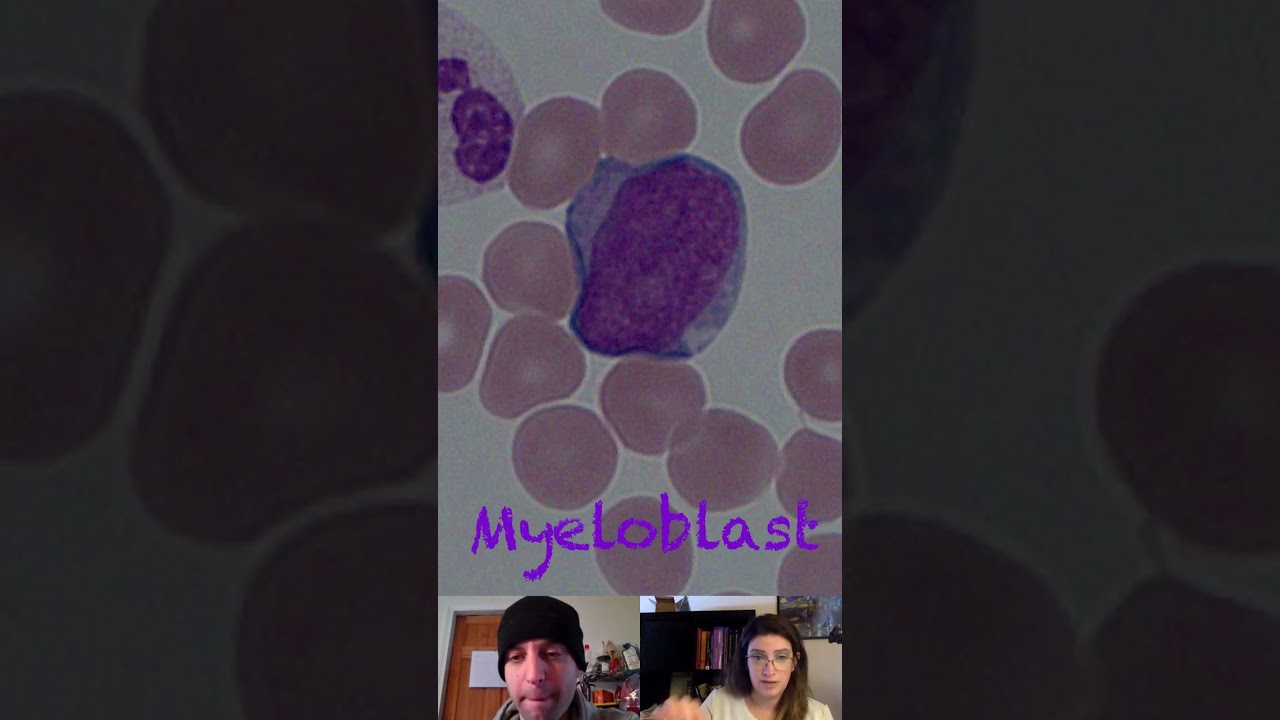 Myeloblast Morphological Characteristics