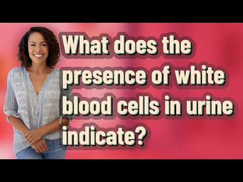 What does the presence of white blood cells in urine indicate?