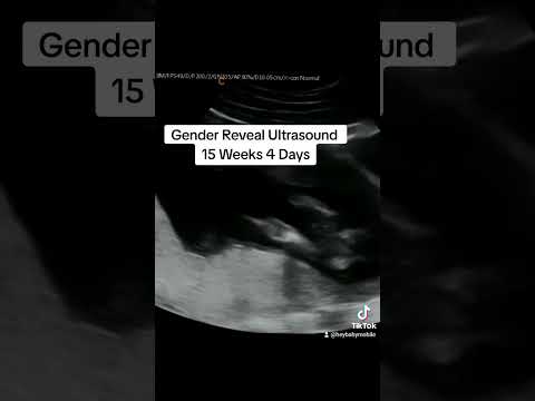 Gender Reveal Ultrasound at 15 weeks 4 days pregnant!