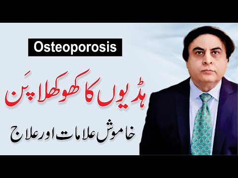 Osteoporosis - Causes, Symptoms & Treatment | Bone Disease By Dr. Khalid Jamil