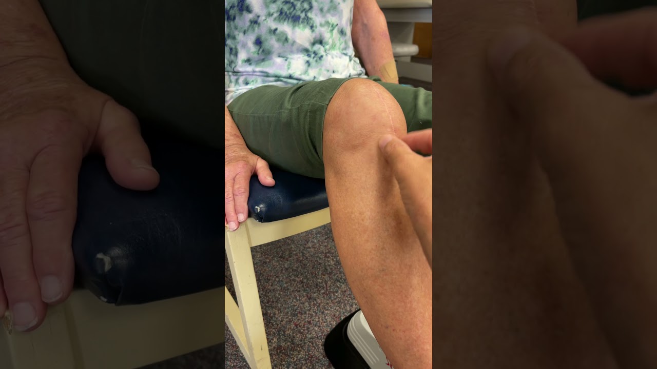 Pain at Outside of Knee - Not Part Of Knee Replacement