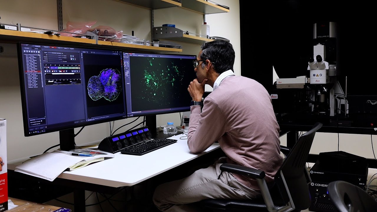 Brain Development Research: The Ranmal Samarasinghe Lab