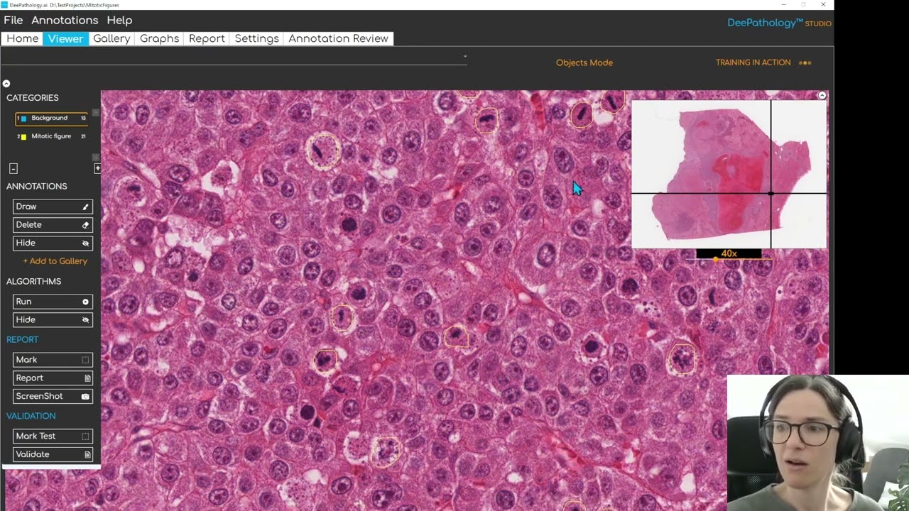 DeePathology™ STUDIO web - Deepathology