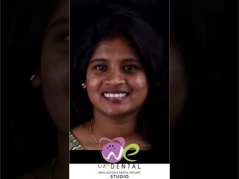 Smile Correction|Smile Design treatment|We Dental|Dr Arshad|Cosmetic Dentistry|Dentistry|Coimbatore