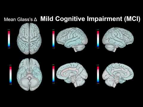Regional brain volume changes in Hakim’s disease versus Alzheimer’s and mild cognitive impairment