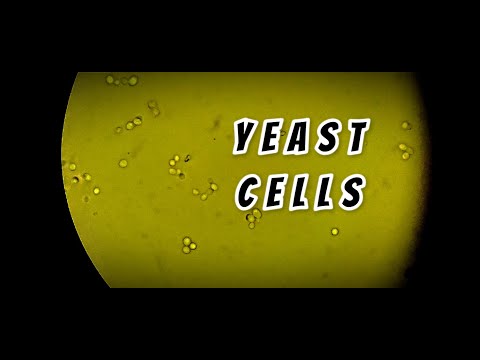 Yeast cells in stool routine Microscopy || @labmedicine9265