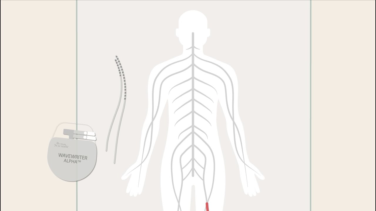 Boston Scientific - How SCS Works
