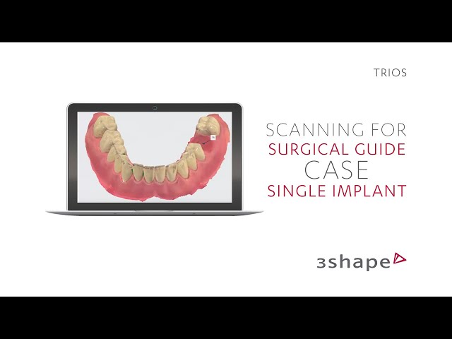Intraoral Scanner - 3 Shape Trios 3 Intraoral Scanner Trader ...