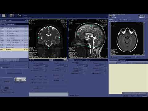 BRAIN MRV Planning with GE Scanner
