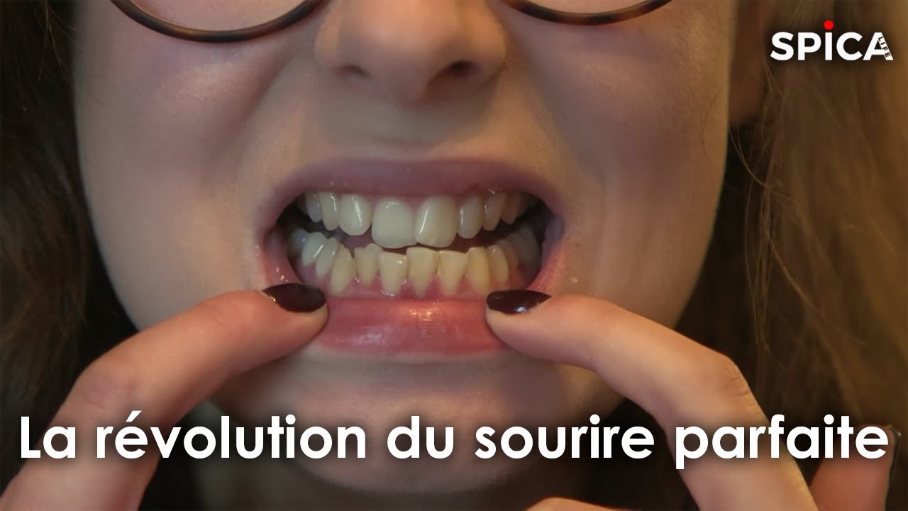 Documentaire | La révolution du sourire parfait