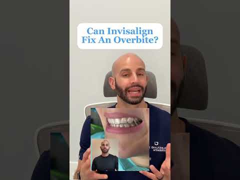Can Invisalign Fix An Overbite? And What About Jaw Surgery?