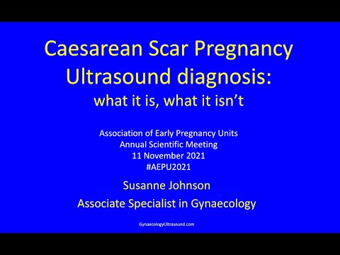 The Ultrasound Diagnosis of a Caesarean Scar Pregnancy for AEPU 2021 FI