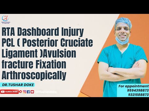 RTA Dashboard Injury PCL ( Posterior Cruciate Ligament )Avulsion fracture Fixation Arthroscopically