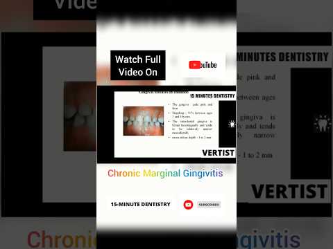 Chronic Marginal Gingivitis | Periodontology Shorts