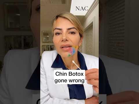 Chin Botox gone wrong #botox #badbotox #drbitafarrell