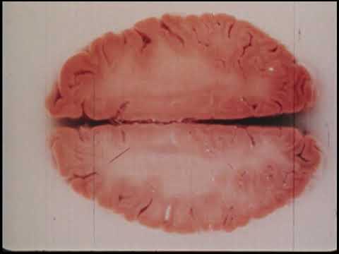 The Human Brain: A Dynamic View... (Robert B. Livingston and Univ of California, 1975)