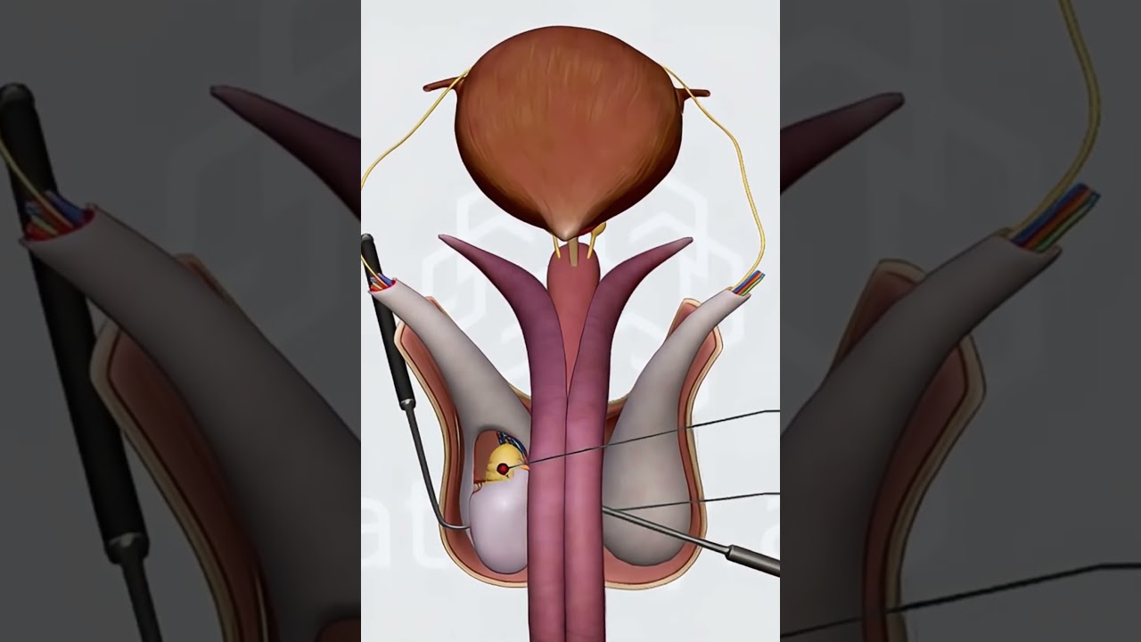 Male Pelvis Anatomy 3D – Organs, Vessels & Reproductive Structures Explained  #anatomy #doctor