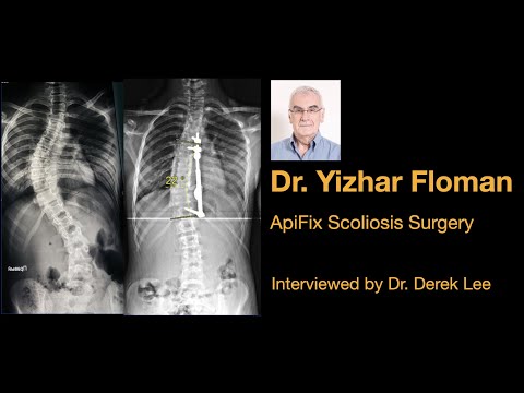 Dr. Yizhar Floman, ApiFix Non-Fusion Scoliosis Surgery, interviewed by Dr. Derek Lee