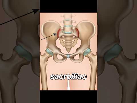Sacroiliitis // lower back pain