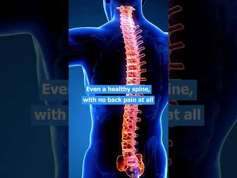 MRI, should you do it or not? This will help you decide 👍