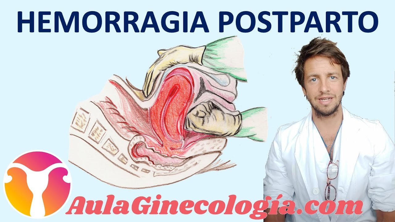 Postpartum Hemorrhage: Causes and Treatments That Can Save Lives - Gynecology and Obstetrics -
