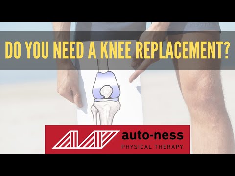 Knee Pain? or Knee Replacement: Know the Differences - Professional ...