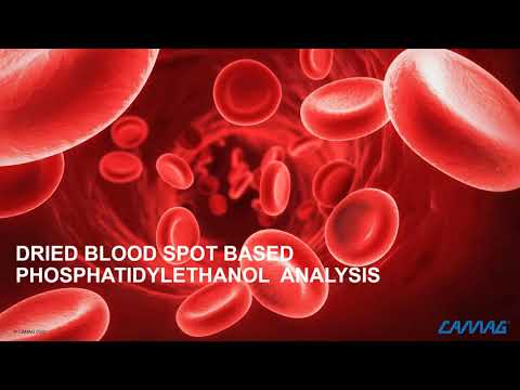 Fully Automated Analysis of Phosphatidylethanol from Dried Blood Spots with Hematocrit Correction