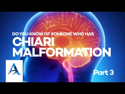 Do you know of someone who has Chiari Malformation?
